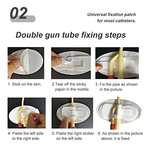 Snapklik.com : 4 Pack Catheter Stabilization Device Tape, Catheter Tube ...