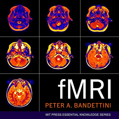 fMRI: MIT Press Essential Knowledge Series (Audio Download): Peter A ...
