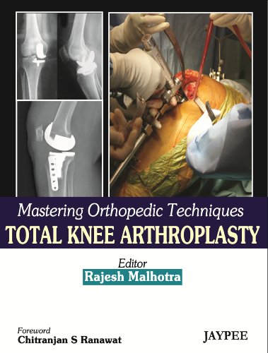 Total knee arthroplasty Edition – Mezene Store