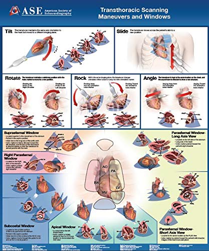Comprehensive TTE Scanning Maneuvers and TTE Protocol Poster Set ...