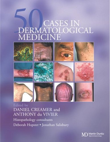 50 Cases in Dermatological Medicine - Kindle edition by du Vivier ...