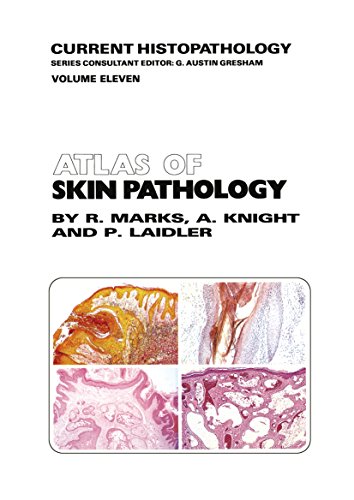 Atlas of Skin Pathology (Current Histopathology Book 11) eBook : Marks ...