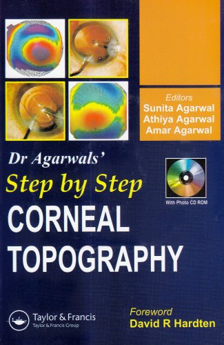 Step by Step Corneal Topography: 9781841845470: Medicine & Health ...