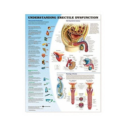 Amazon.com: Male Erectile Dysfunction EDS Chart : Toys & Games