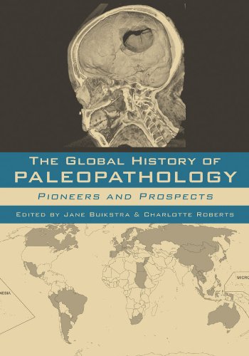 The Global History of Paleopathology: Pioneers and Prospects 1 ...