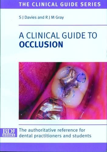 Buy A Clinical Guide to Occlusion (Clinical Guide S.) Book Online at ...