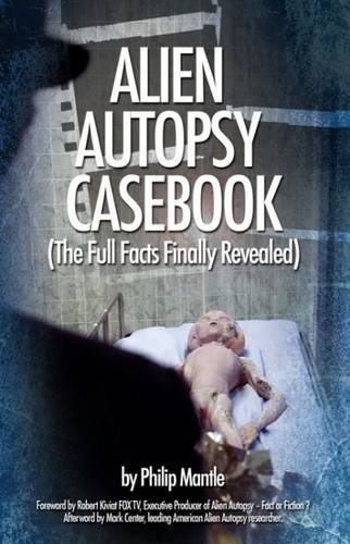 Alien Autopsy Casebook, The Full Facts Finally Revealed: Philip Mantle ...