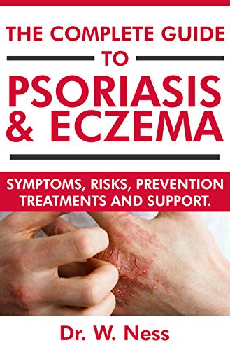 Amazon.com: The Complete Guide to Psoriasis & Eczema: Symptoms, Risks ...