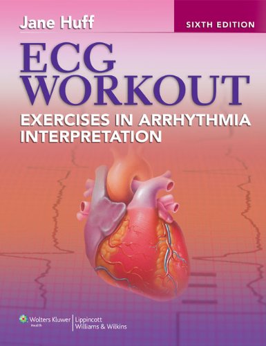 Huff ECG Workout 6th Ed. + Allender Community & Public Health Nursing ...