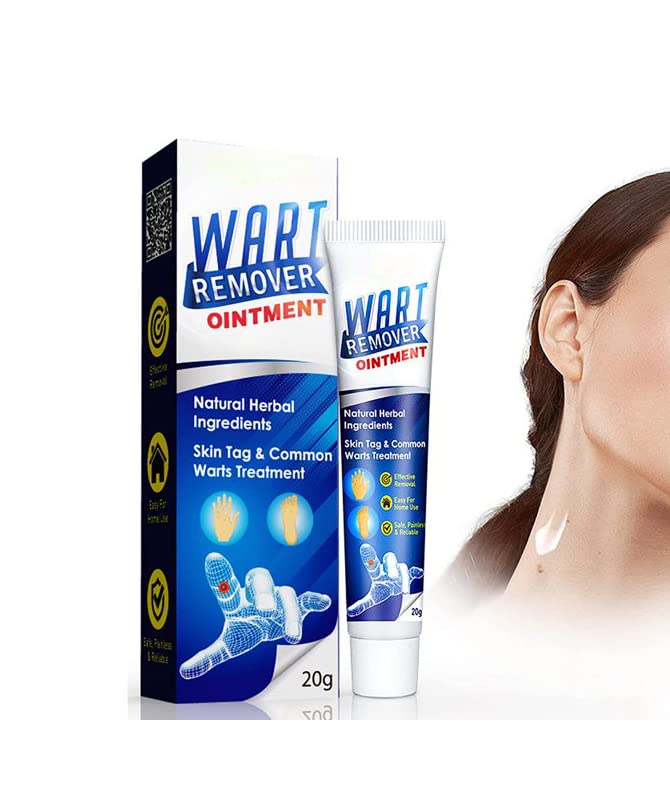 Buy 100g Warts Remover Cream Extract Skin Face Extract Corn Treatment ...