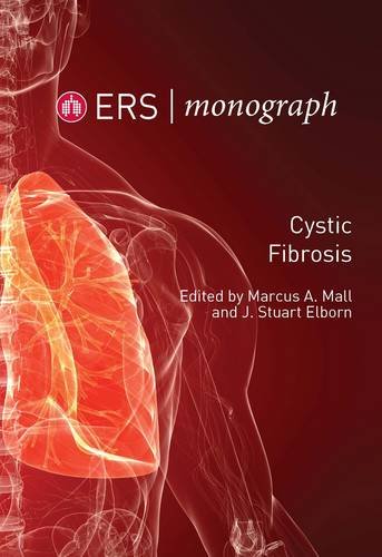 Cystic Fibrosis (ERS Monograph, Band 64) : Mall, Marcus A., Elborn, J ...