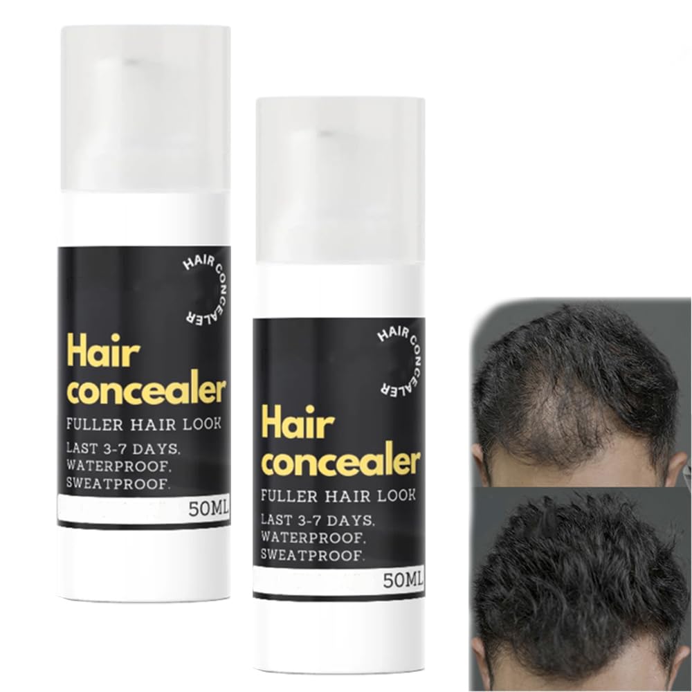 Amazon.com: Hairfillup-Hairfillup Hair Concealer, Hair Fillup Hair ...