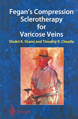 Fegan’s Compression Sclerotherapy for Varicose Veins - Kindle edition ...