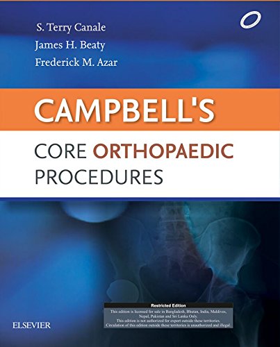 Campbells Core Orthopaedic Procedures : Canale: Amazon.co.uk: Books