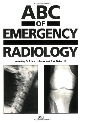 ABC of Emergency Radiology (ABC Series): 9780727908322: Medicine ...