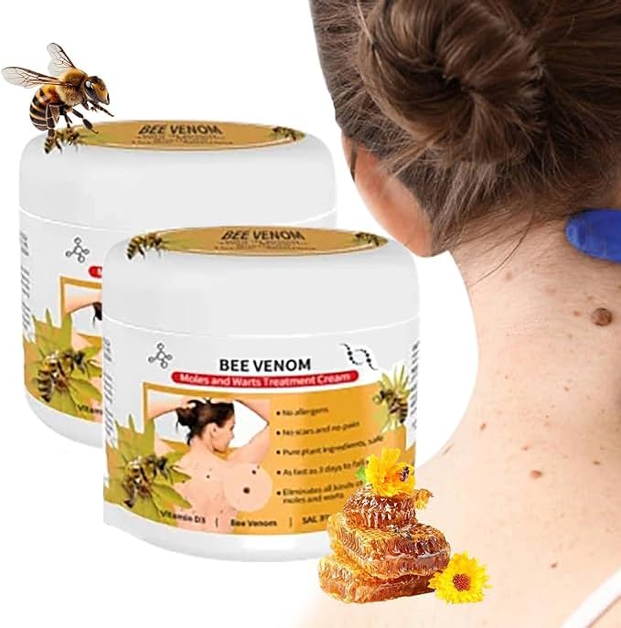Buy LenaroBee Venom Wart and Tag Remover Cream, Bee Venom Mole and Wart ...