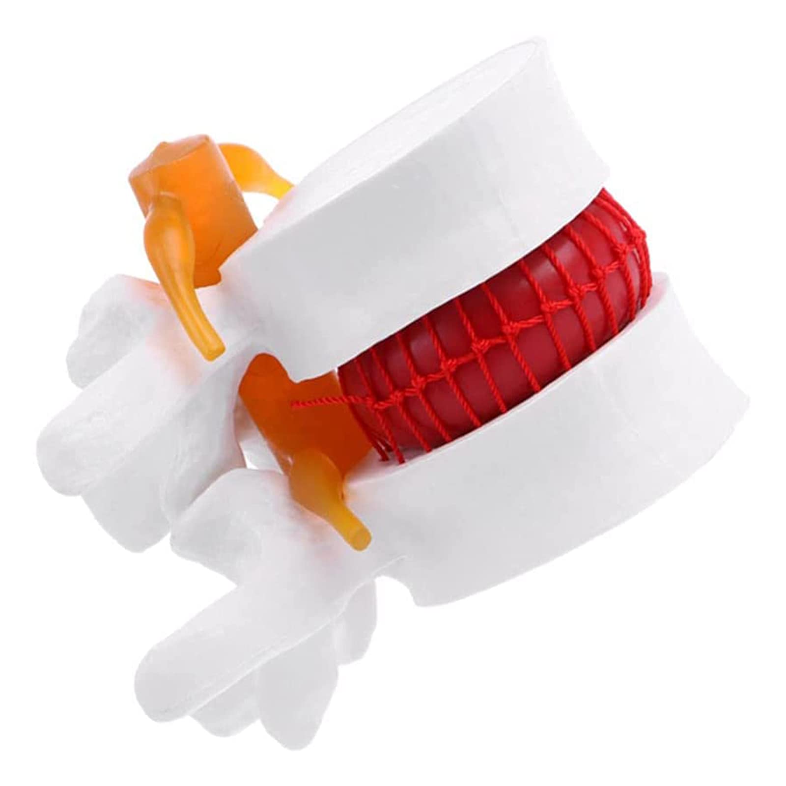 Buy Human Lumbar Disc Herniation Model, Anatomy Lumbar Disc Herniation ...