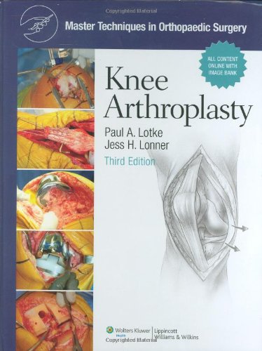 Knee Arthroplasty (Master Techniques in Orthopaedic Surgery): Amazon.co ...