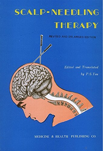Scalp-Needling Therapy: Amazon.co.uk: Books