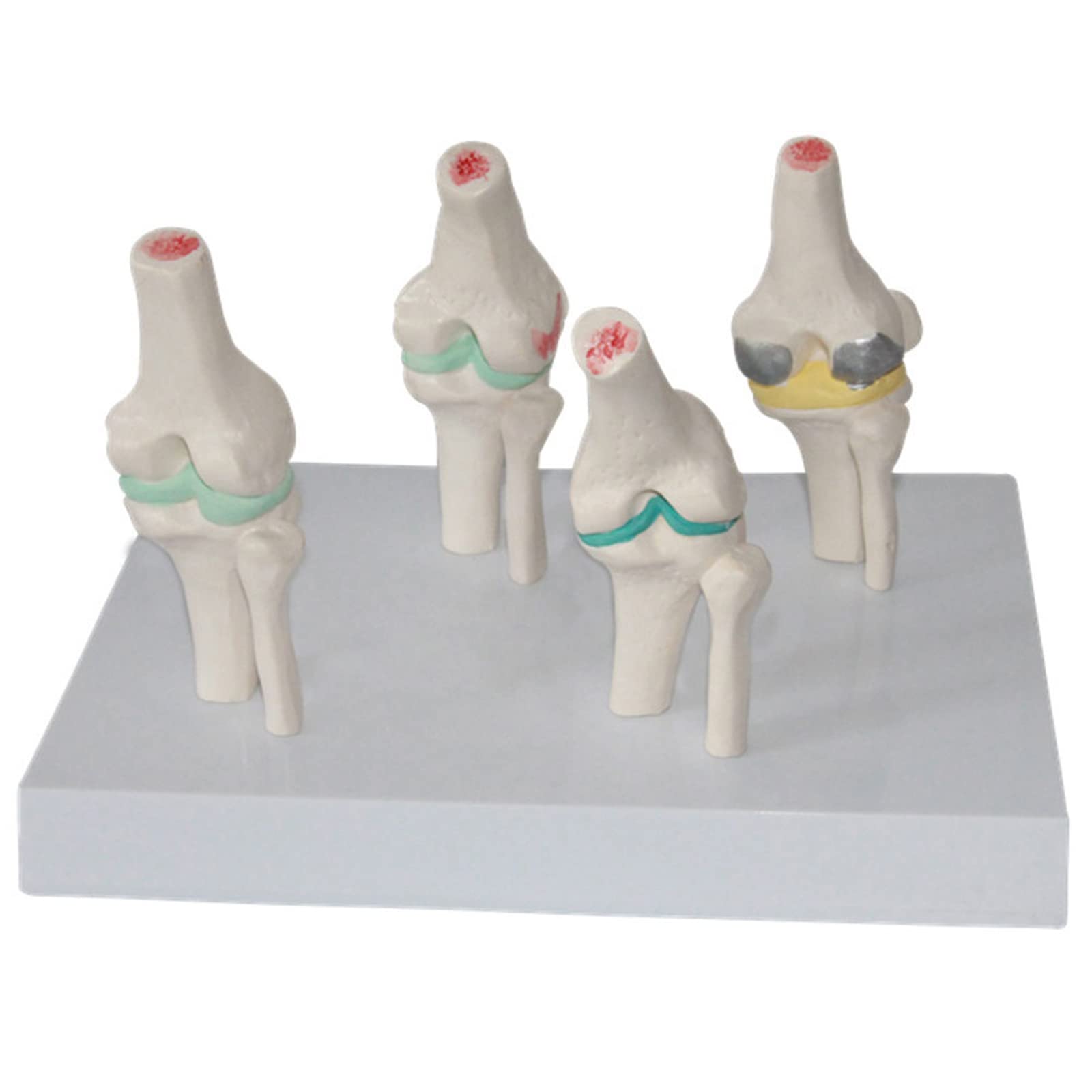 Buy Human Body Knee Joint Model, Human Body Anatomy Replica Set Of 4 ...