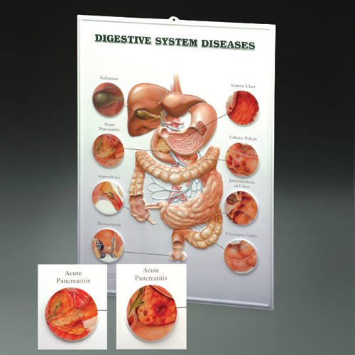 Digestive System Diseases : Anatomical Chart Company: Amazon.es: Libros