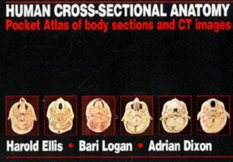 Human Cross-Sectional Anatomy: Pocket Atlas of Body Sections and CT ...