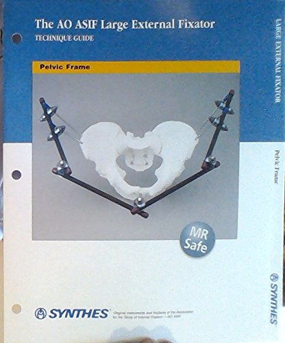 The AO ASIF Large External Fixator Technique Guide: Pelvic Frame ...