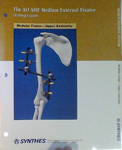 The AO ASIF Medium External Fixator Technique Guide: Modular Frame ...
