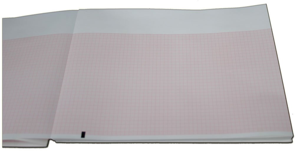 Amazon.com: Mortara Chart Paper - 215mm X 280mm X 200 Sheets w/White ...