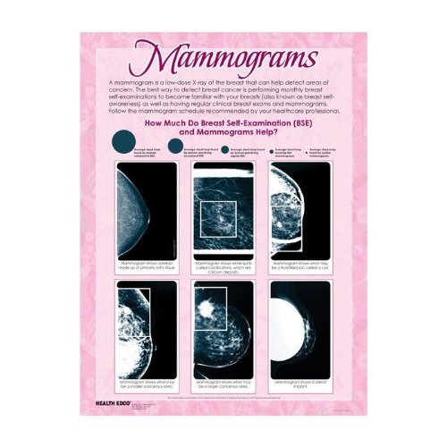 Amazon.com: Mammograms Chart : Home & Kitchen