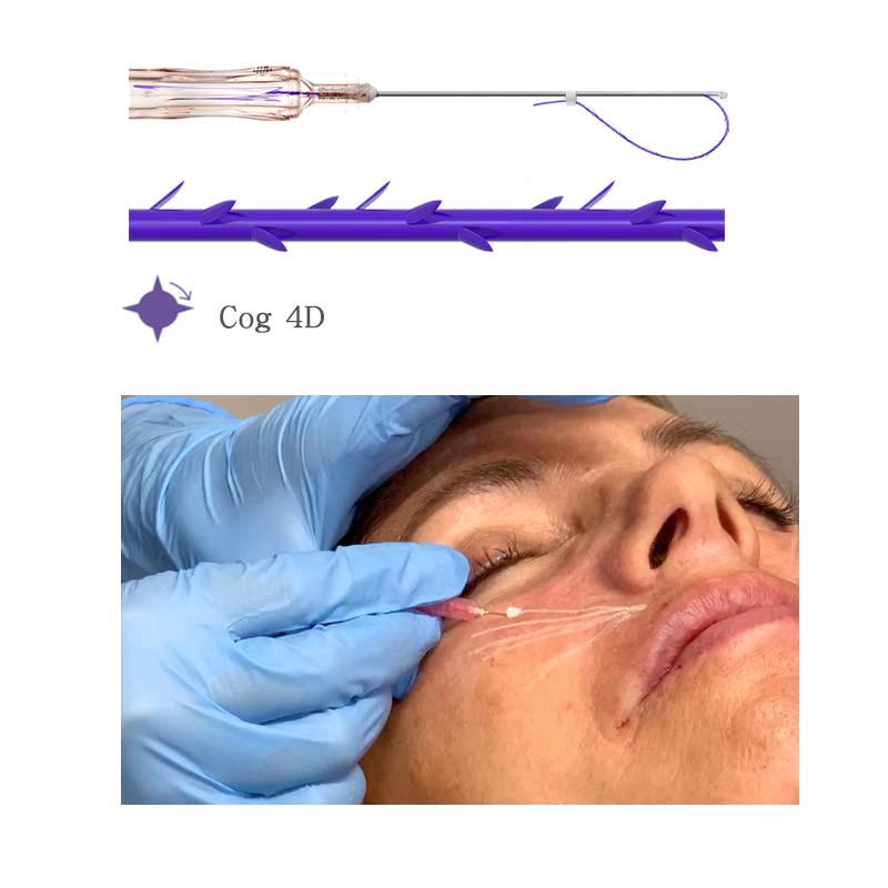 Pdo Cog Pdo Thread Cog para cara y cuerpo entero engranaje 4D W 21G 90M ...