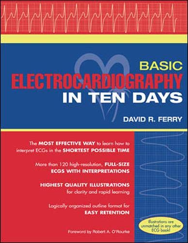 Buy Basic Electrocardiography in Ten Days Book Online at Low Prices in ...