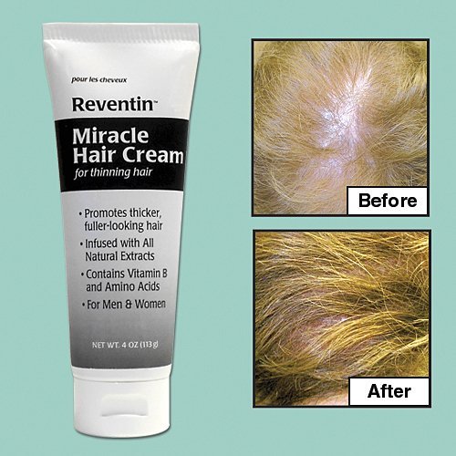 Amazon.com : Reventin Miracle Hair Cream for Thinning Hair : Hair ...