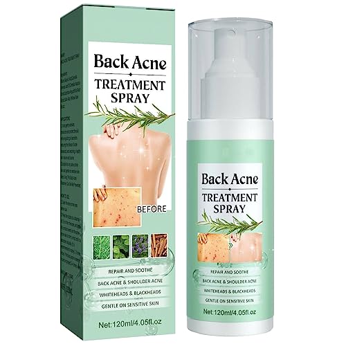 Top 10 Best Bras For Back Acne : Reviews & Buying Guide - Katynel