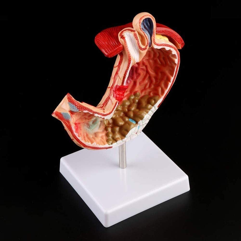 Buy QIQIZHANG Anatomy Model, 00 Human Stomach Anatomy Model tric ...