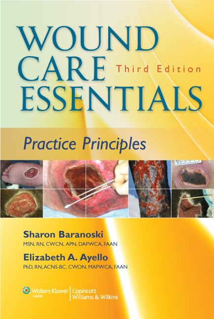 Wound Care Essentials: Practice Principles: 9781451113044: Medicine ...