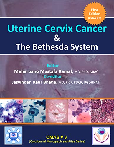 Uterine Cervix Cancer The Bethesda System: CMAS # 3 (CMAS (CytoJournal ...