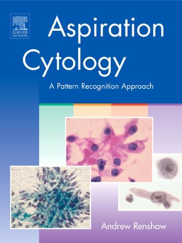 Aspiration Cytology: A Pattern Recognition Approach: 9781416028703 ...