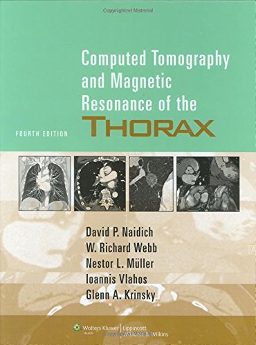 Computed Tomography And Magnetic Resonance of the Thorax: 9780781757652 ...