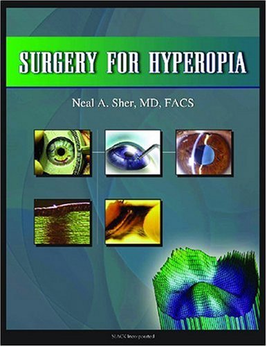 Surgery for Hyperopia : Sher, Neal: Amazon.com.be: Books