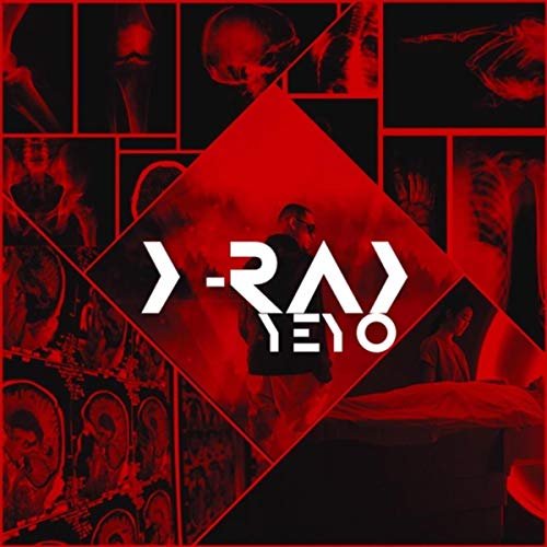 X-Ray by Yeyo on Amazon Music - Amazon.co.uk