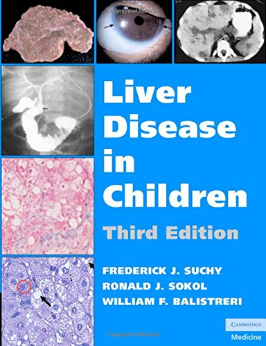 Liver Disease in Children: Amazon.co.uk: Suchy, Frederick J., Sokol ...