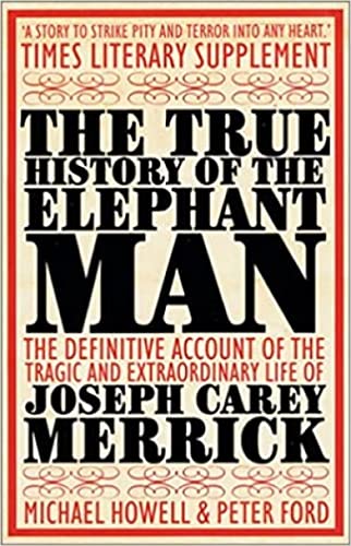 The Elephant Man Real Story