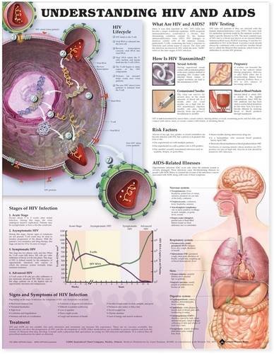 Buy Understanding HIV and AIDS Anatomical Chart in Spanish (Entendiendo ...