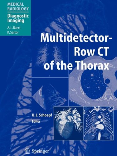 Multidetector-Row CT of the Thorax : U. Joseph Schoepf: Amazon.in: Books