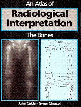 An Atlas Of Radiological Interpretation: John F. Calder: 9780723409533 ...
