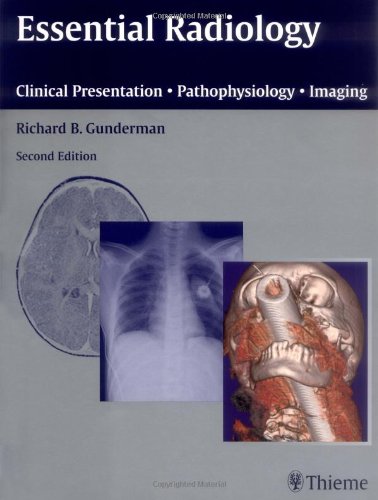 Amazon.com: Essential Radiology: 9783131104724: Richard B. Gunderman: Books