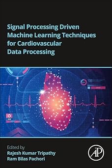 Amazon | Signal Processing Driven Machine Learning Techniques for ...