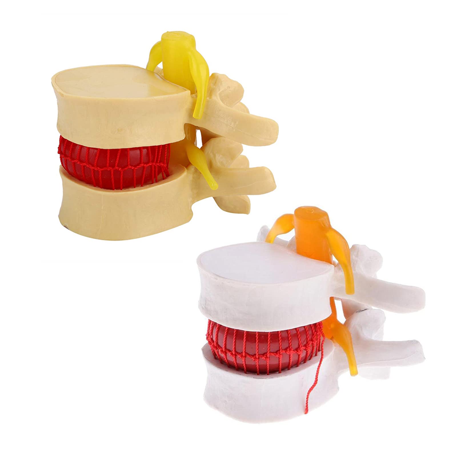 Buy Human Lumbar Disc Herniation Model, 1: 1.5 Human Lumbar Disc ...
