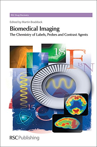 Biomedical Imaging: The Chemistry of Labels, Probes and Contrast Agents ...
